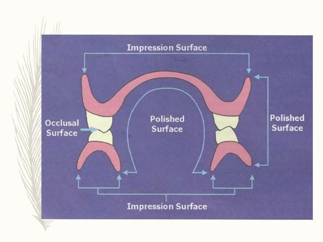 7. RETENTION IN COMPLETE DENTURE.pptx