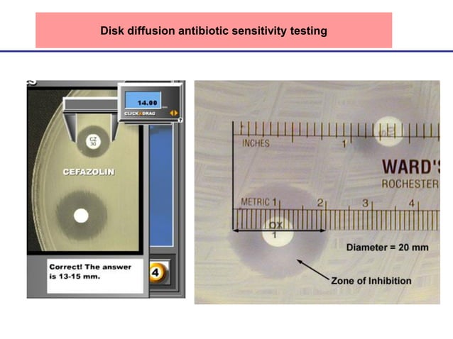 7._LS_ang_Pract_ATB_sensitivity_testing.pdf