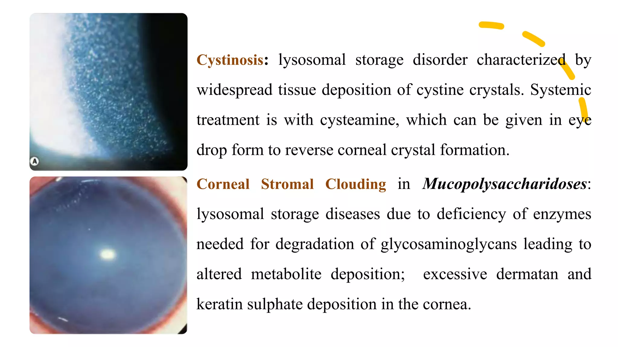7. ocular, Systemic disease.pptx