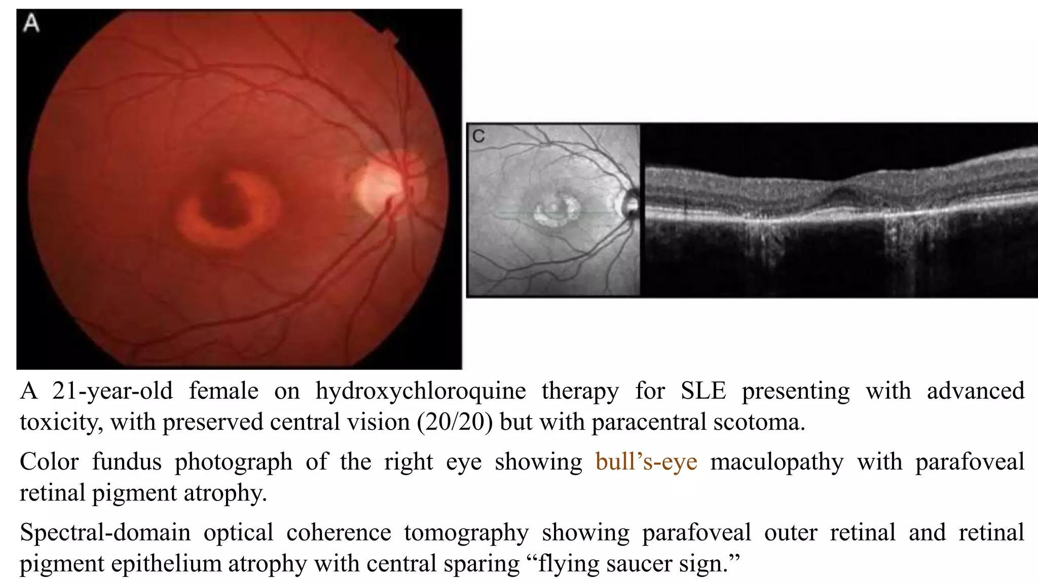 7. ocular, Systemic disease.pptx