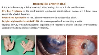 7. ocular, Systemic disease.pptx