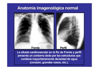 Semiologia Radiológica Cardiovascular Básica. | PPTX