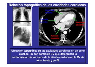 Semiologia Radiológica Cardiovascular Básica. | PPTX