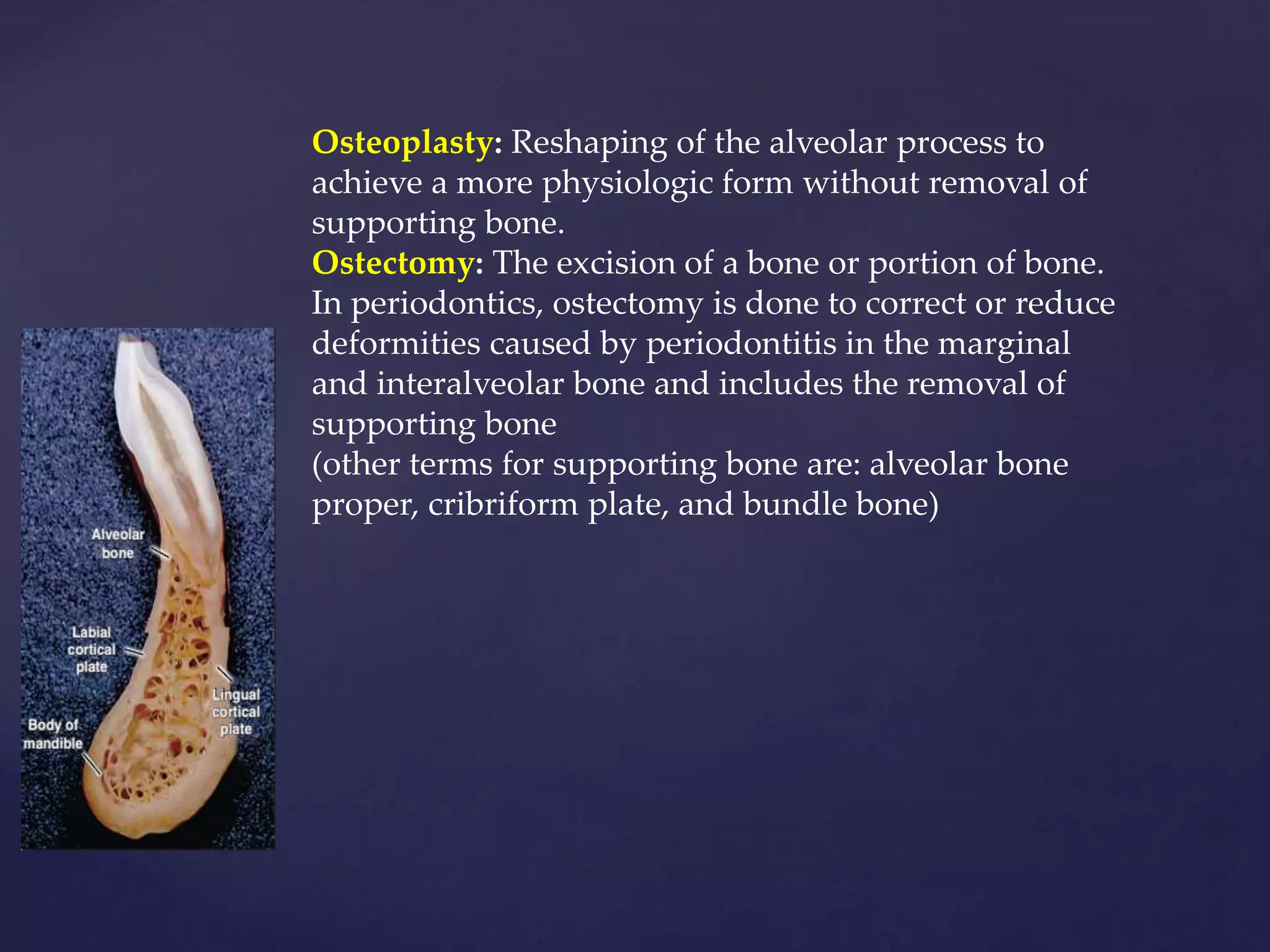 7. Remodeling Resective Osseous Surgery.pptx