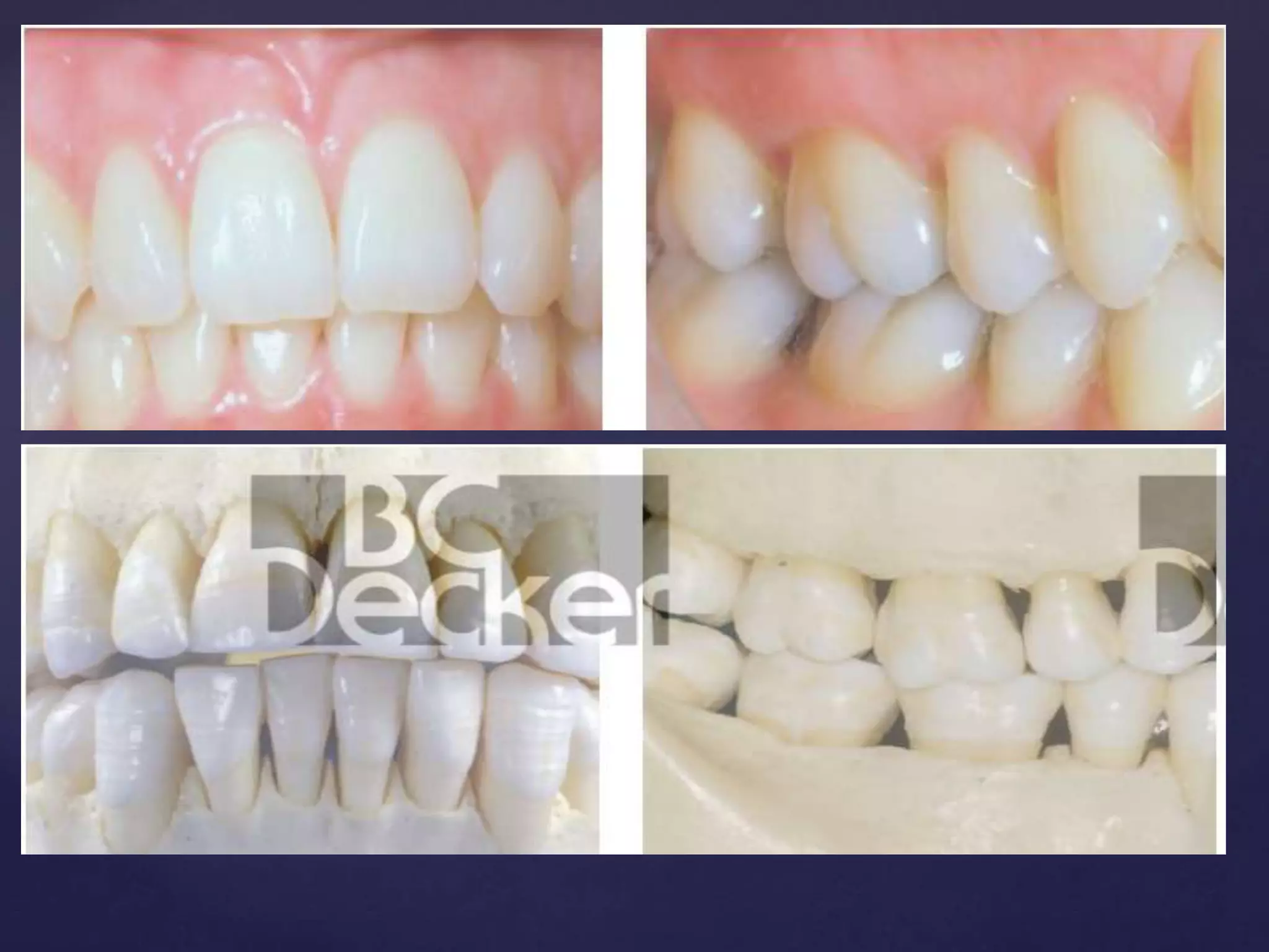 7. Remodeling Resective Osseous Surgery.pptx