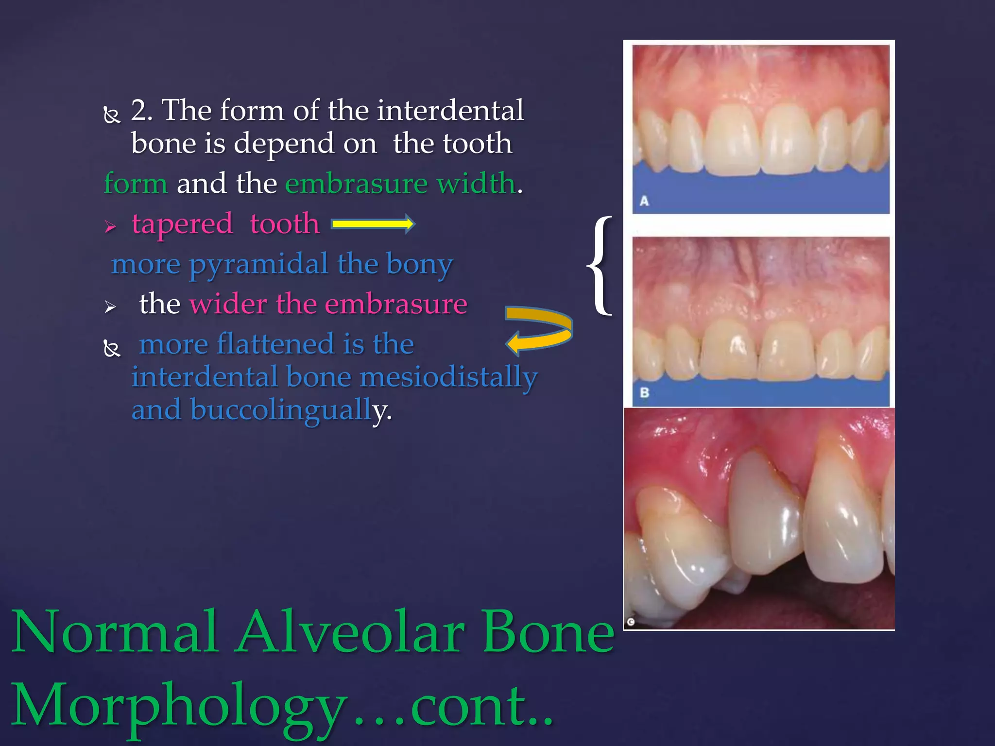 7. Remodeling Resective Osseous Surgery.pptx