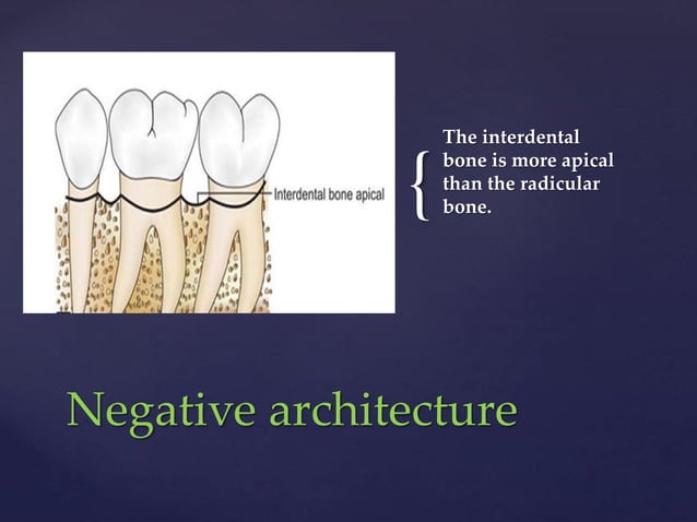 7. Remodeling Resective Osseous Surgery.pptx