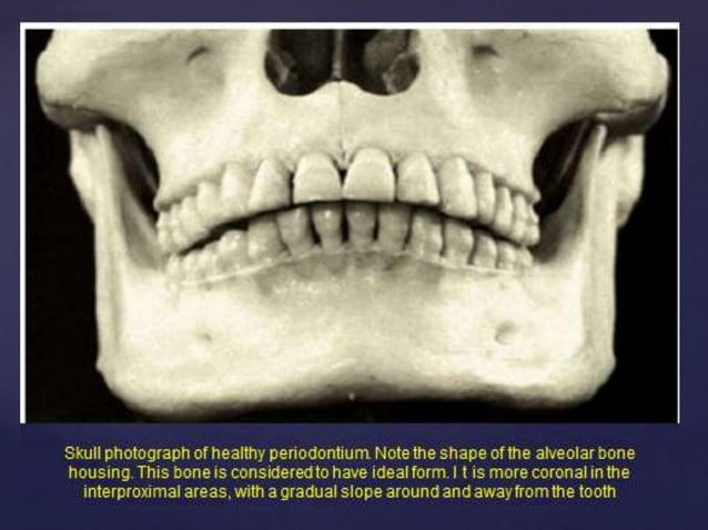 7. Remodeling Resective Osseous Surgery.pptx