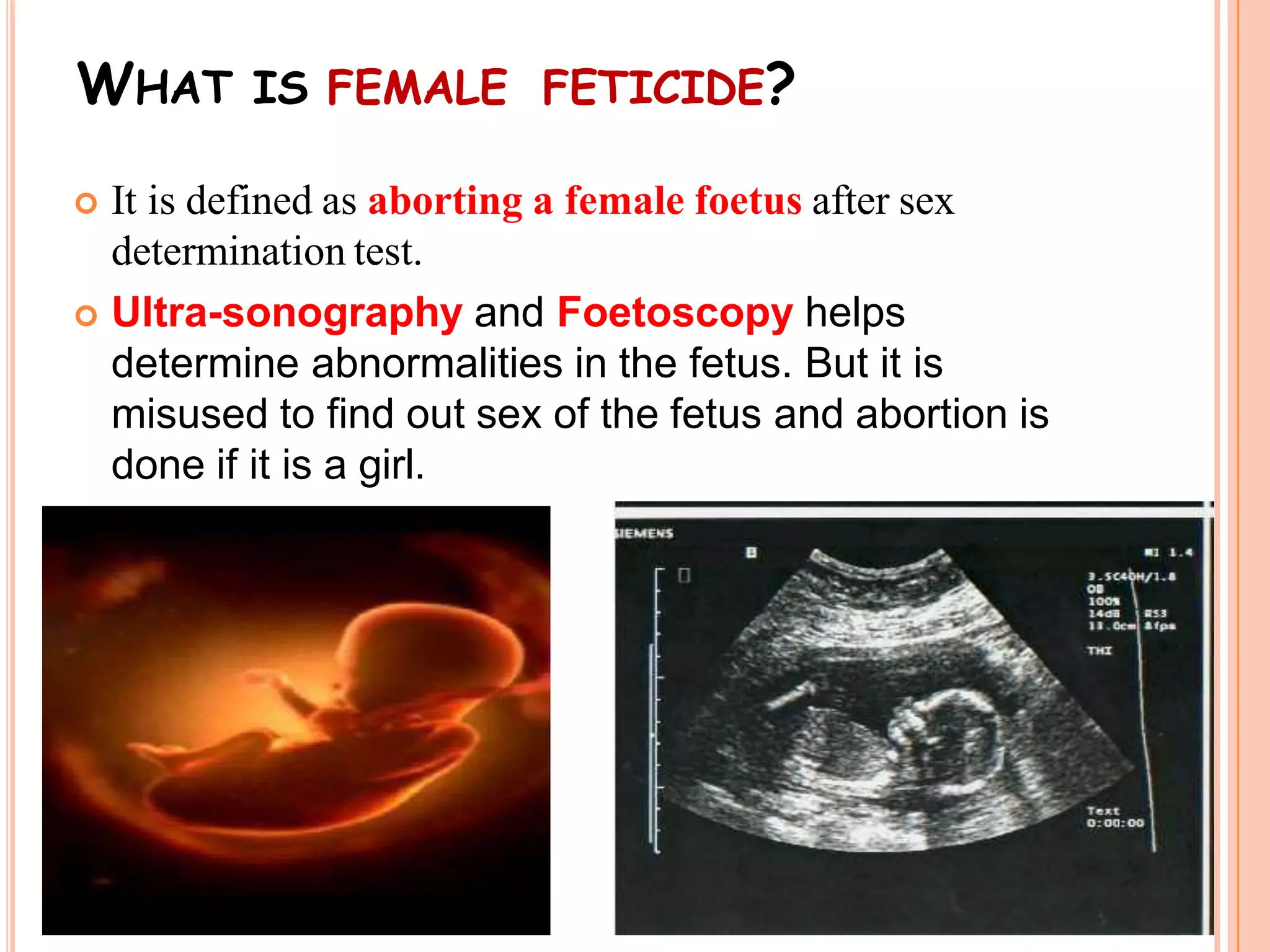 Female Foeticide.pptx