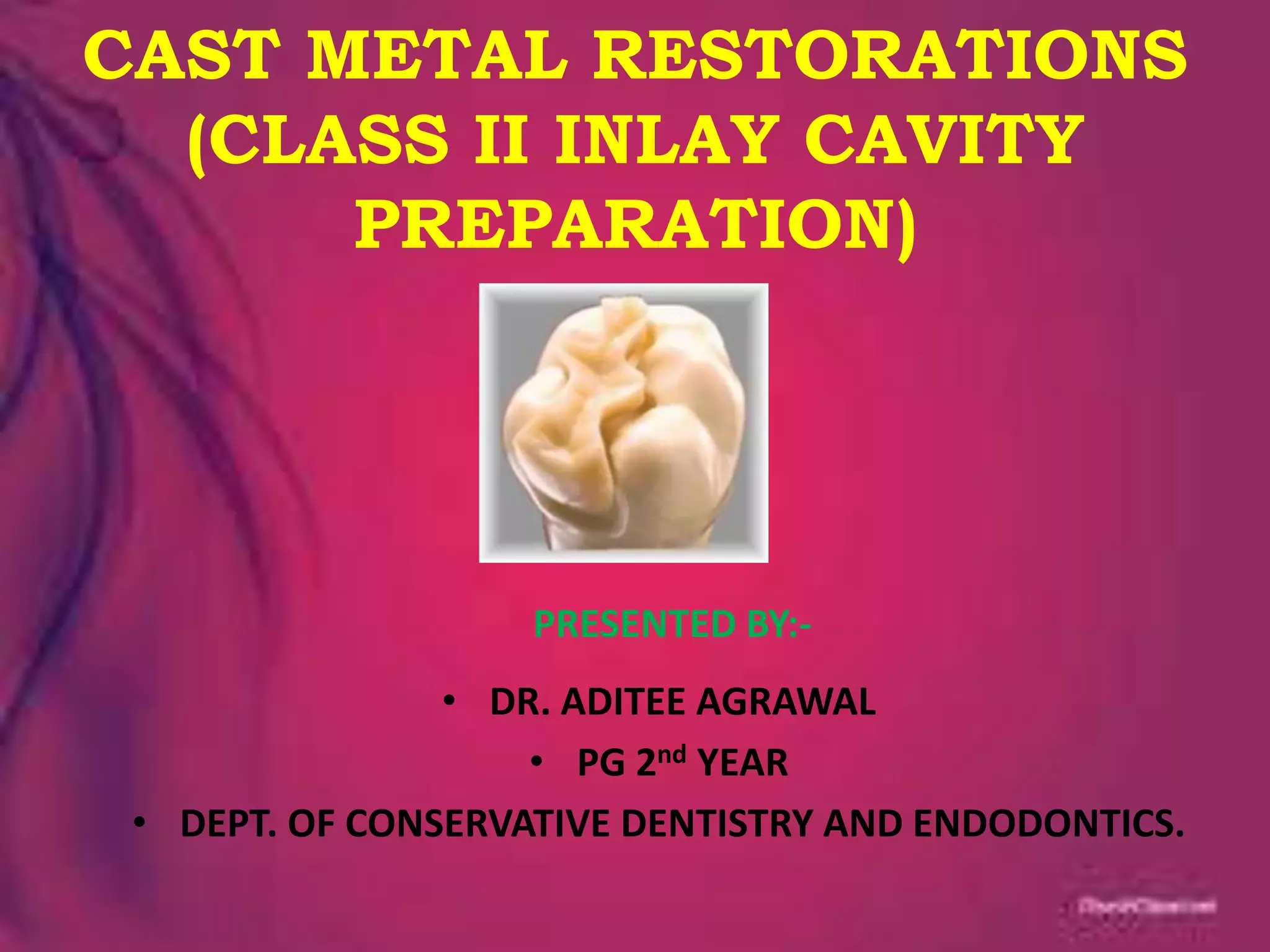 7.CLASS II INLAY CAVITY PREPARATION.pptx | Oral care | Personal Care