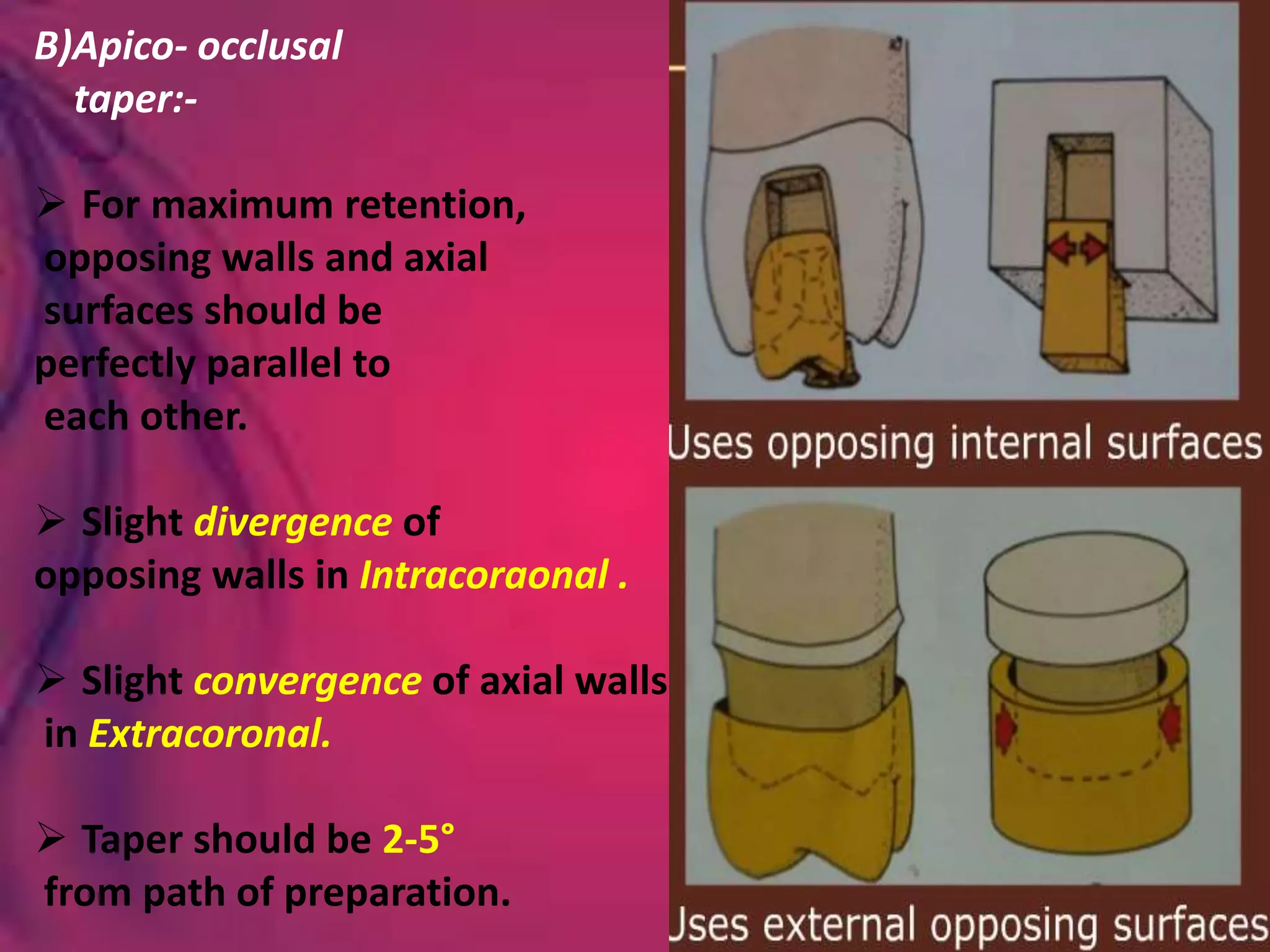 7.CLASS II INLAY CAVITY PREPARATION.pptx