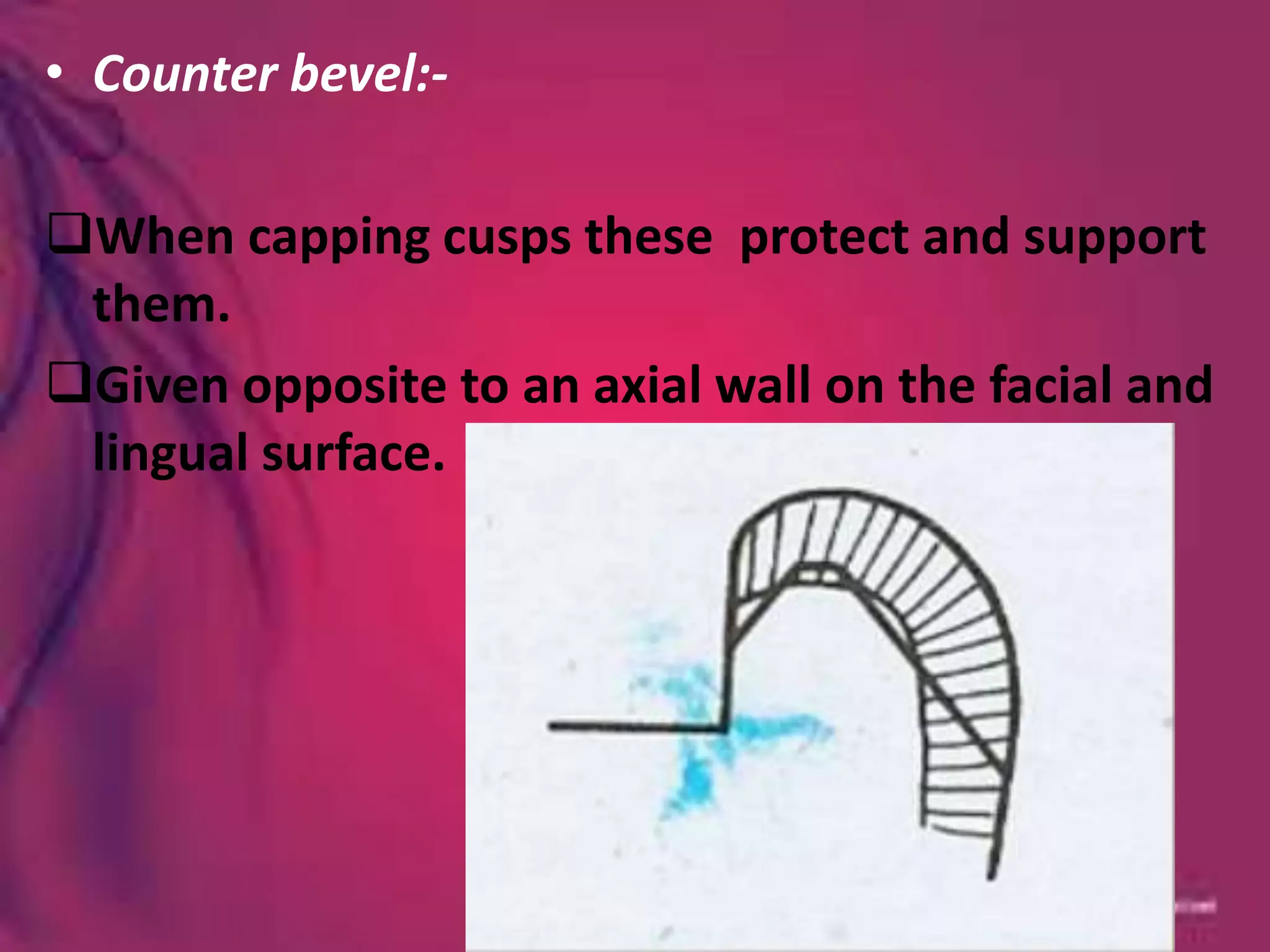 7.CLASS II INLAY CAVITY PREPARATION.pptx
