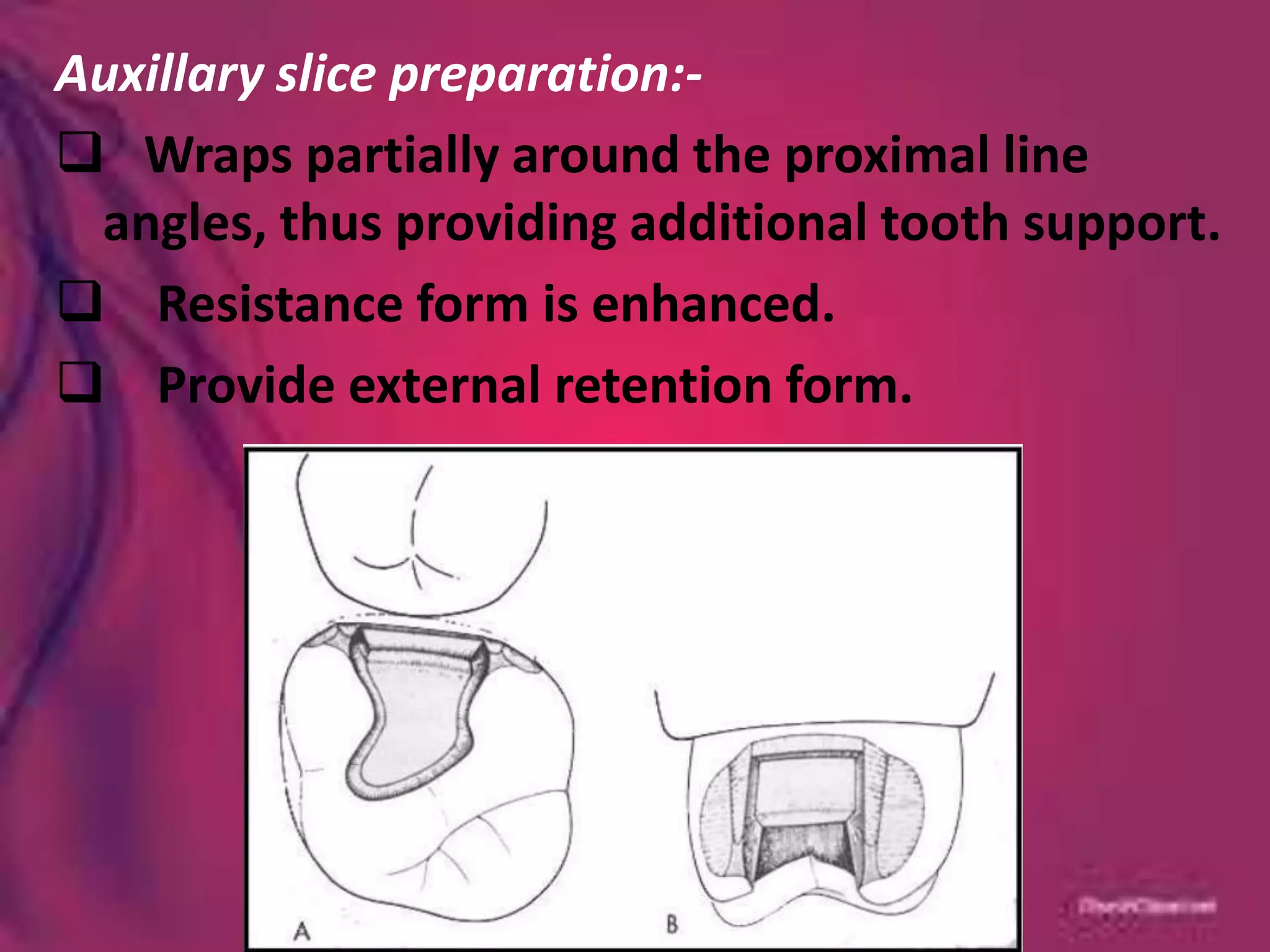 7.CLASS II INLAY CAVITY PREPARATION.pptx