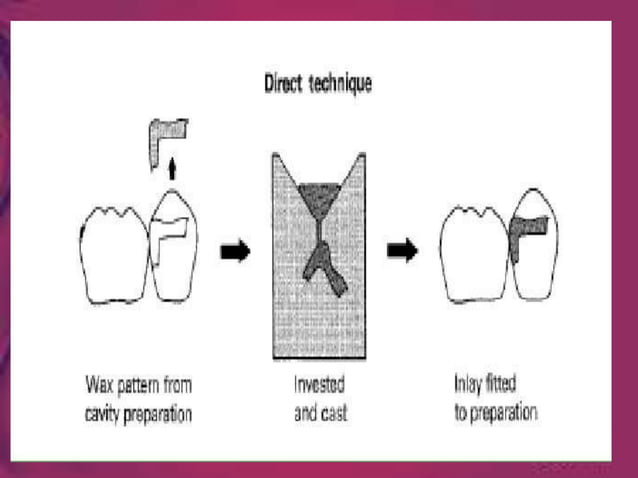 7.CLASS II INLAY CAVITY PREPARATION.pptx | Oral care | Personal Care