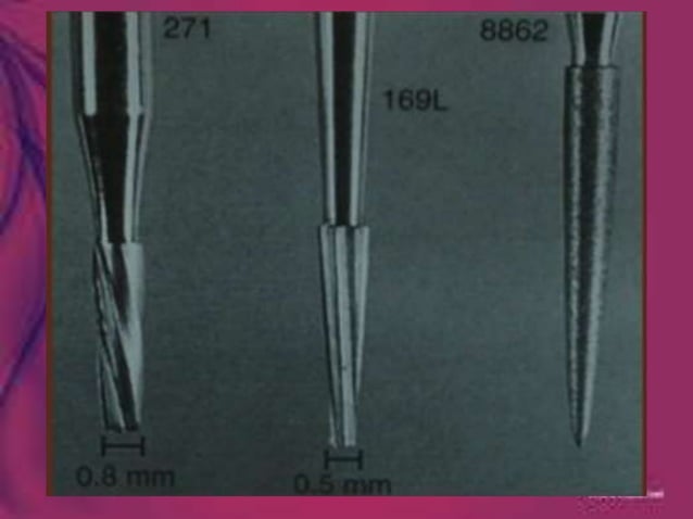 7.CLASS II INLAY CAVITY PREPARATION.pptx | Oral care | Personal Care