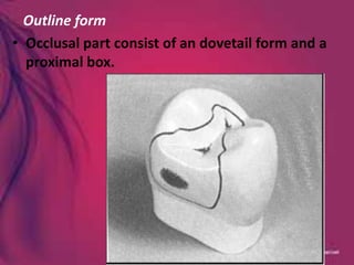 7.CLASS II INLAY CAVITY PREPARATION.pptx