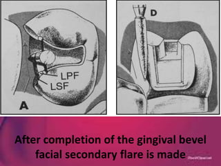 7.CLASS II INLAY CAVITY PREPARATION.pptx