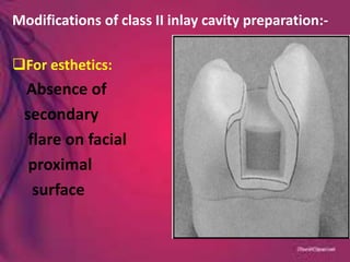 7.CLASS II INLAY CAVITY PREPARATION.pptx