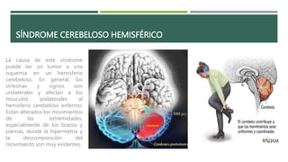 7.-SINDROME CEREBELOSO.pptx
