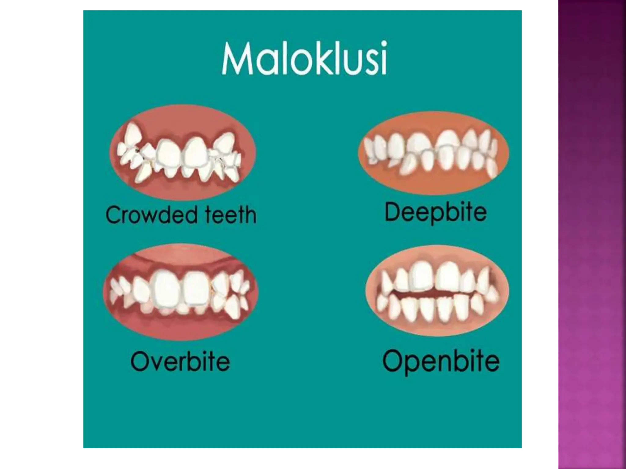 7. RELASI RAHANG, OKLUSI DAN ARTIKULASI.ppt