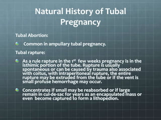 . ECTOPIC GESTATION.ppt. Obstetrics and gyn | PPT