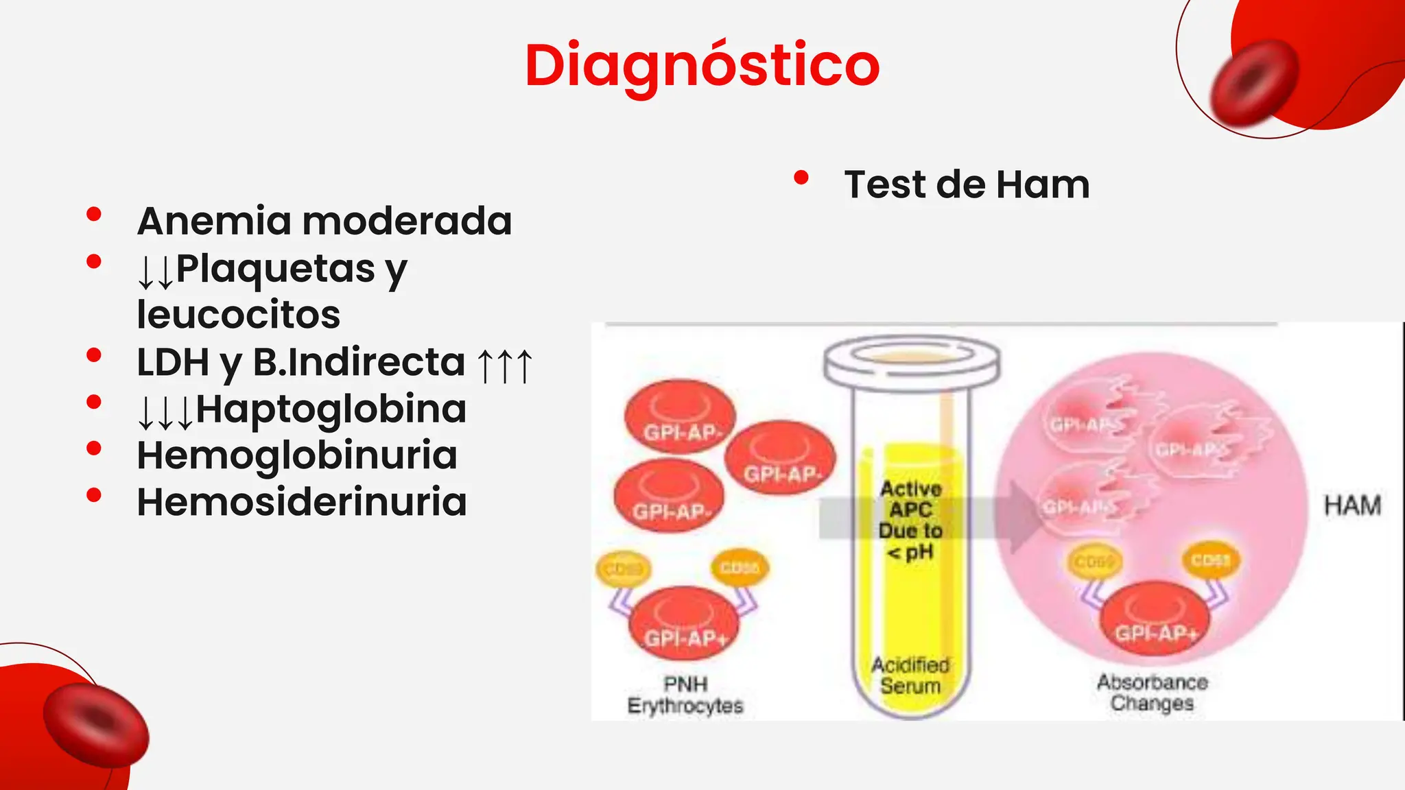 7.Hemoglobinuria Paroxistica nocturna}.pptx