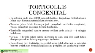 FISIOTERAPI PEDIATRI PADA KASUS - TORTICOLIS.pptx