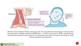 FISIOTERAPI PEDIATRI PADA KASUS - TORTICOLIS.pptx