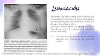 Radiografía normal de tórax valoración y requerimientos minimos ...