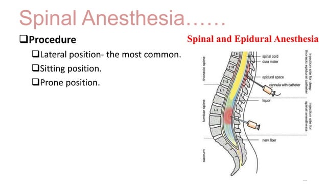 Principles of Anesthesia for Nursing Students | PPTX