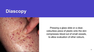 Bedside Tests in Dermatology | PPTX