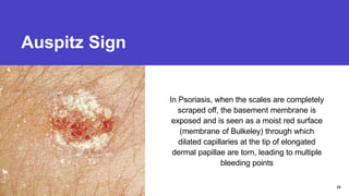 Bedside Tests in Dermatology | PPTX