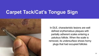 Bedside Tests in Dermatology | PPTX