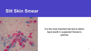 Bedside Tests in Dermatology | PPTX