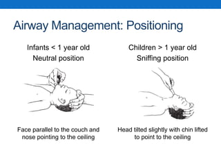 7. Airway 2020.pdfaaaaaaakkkkkkkkkkkkkkk | PDF