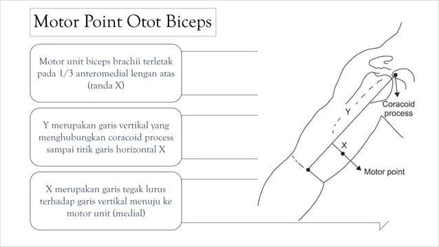 Materi Elektroterapi Fisioterapi Faradic Current | PPT