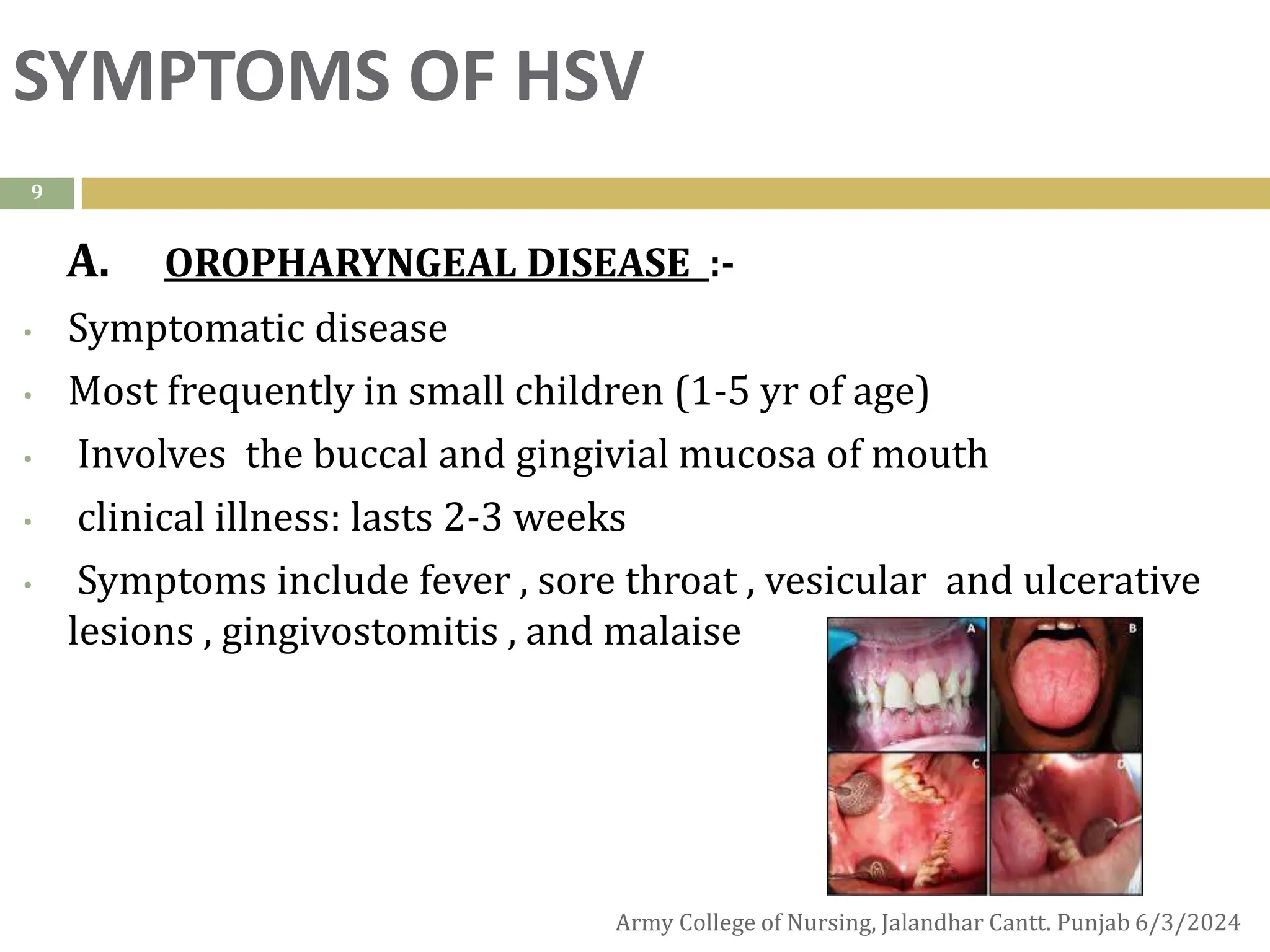 7. HERPES, treatment and nursing management .ppt