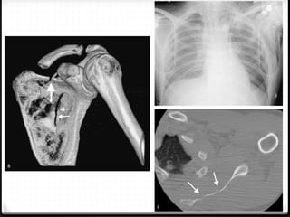 7.-diagnostik-trauma-tttthoraks-dada.pdf