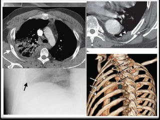 7.-diagnostik-trauma-tttthoraks-dada.pdf