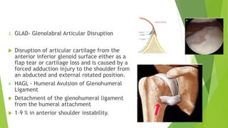 7. Approach to shoulder instability.pptx