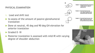 7. Approach to shoulder instability.pptx