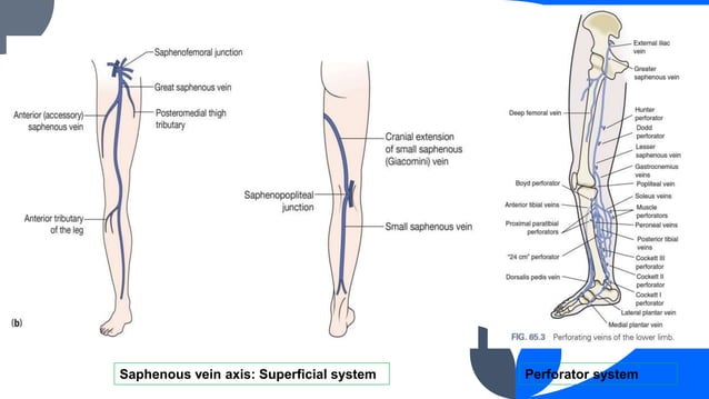 venous ulcer and venous insufficiency.ppt