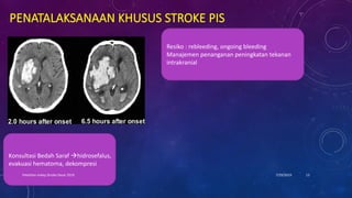 7. Tatalaksana Medik Pasien Stroke 2019 - Askep Dasar Stroke (1).pdf
