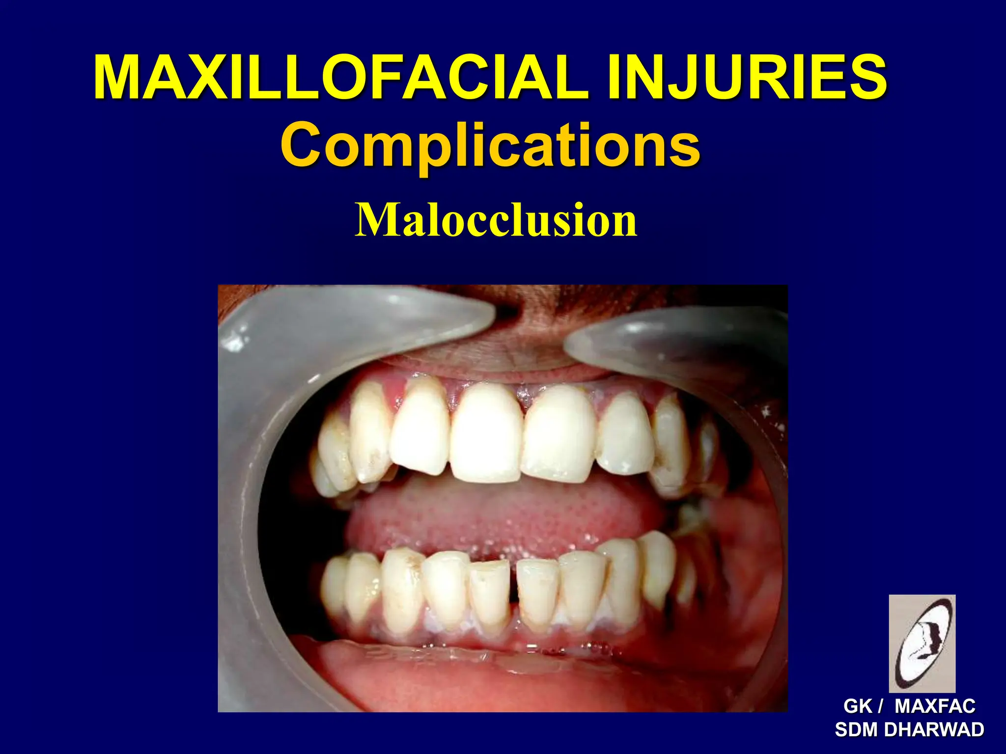 Complications of maxfax injuries pptx. 7 | PPT