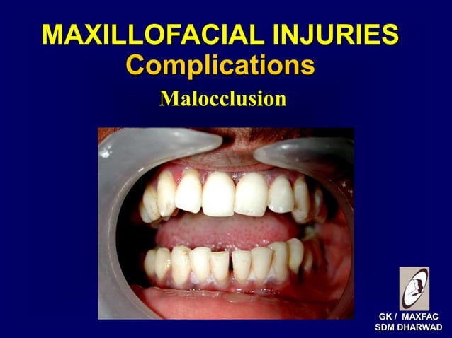 Complications of maxfax injuries pptx. 7 | PPT