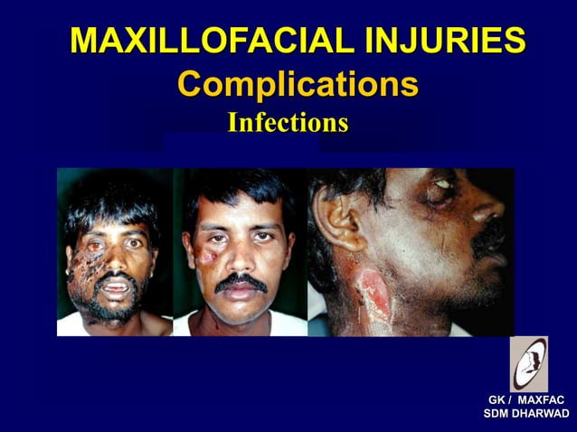 Complications of maxfax injuries pptx. 7 | PPT