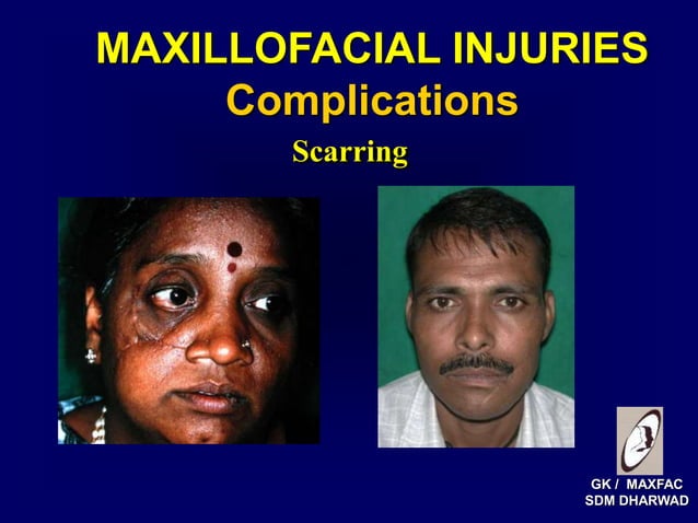 Complications of maxfax injuries pptx. 7 | PPT