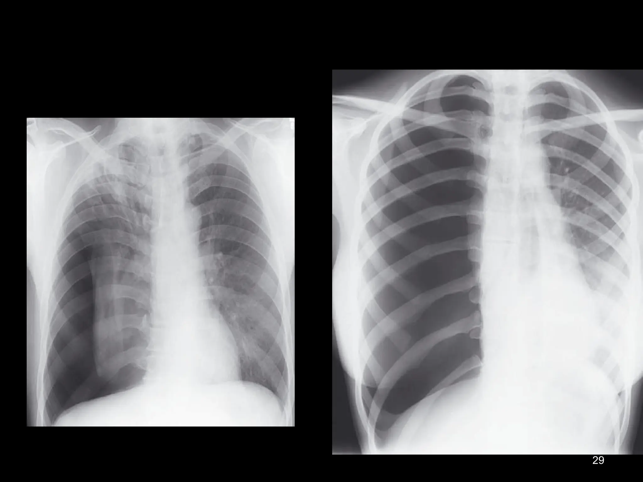 7. INTERPRETATION OF THE ABNORMAL FILM.pptx