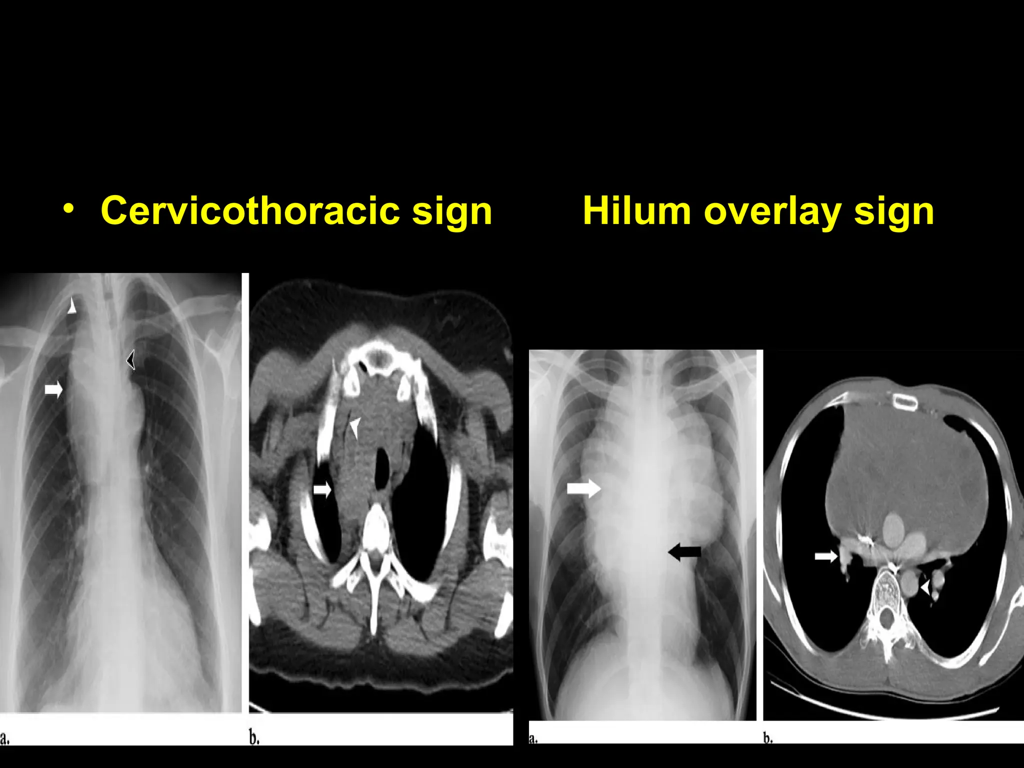 7. INTERPRETATION OF THE ABNORMAL FILM.pptx