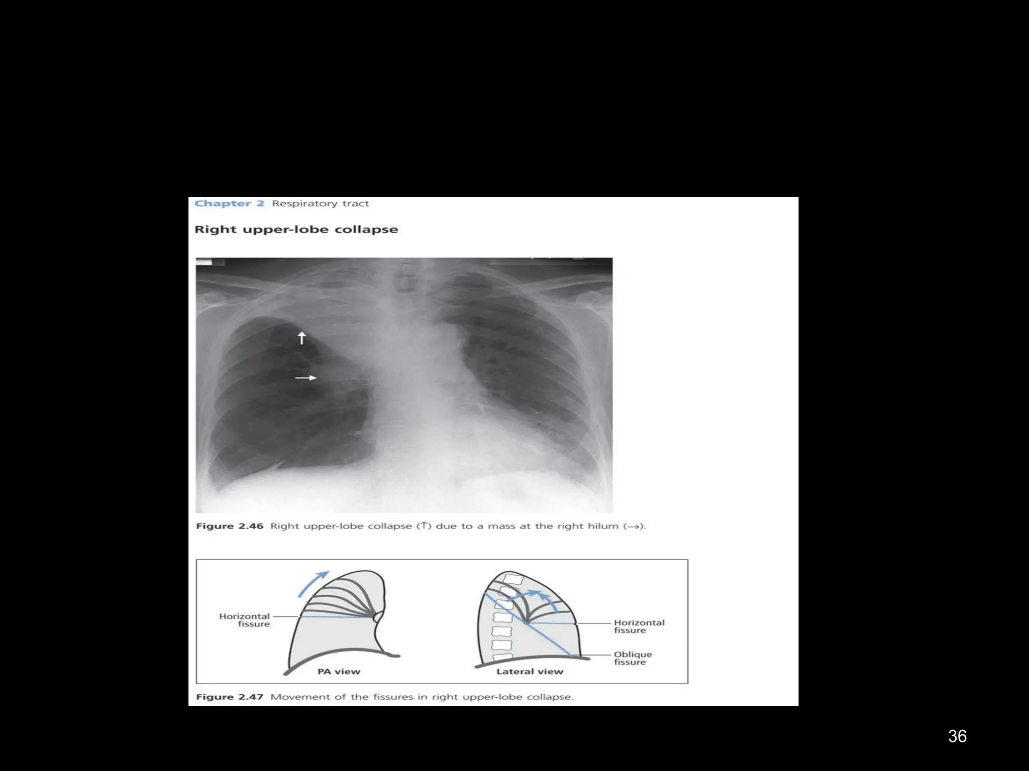 7. INTERPRETATION OF THE ABNORMAL FILM.pptx
